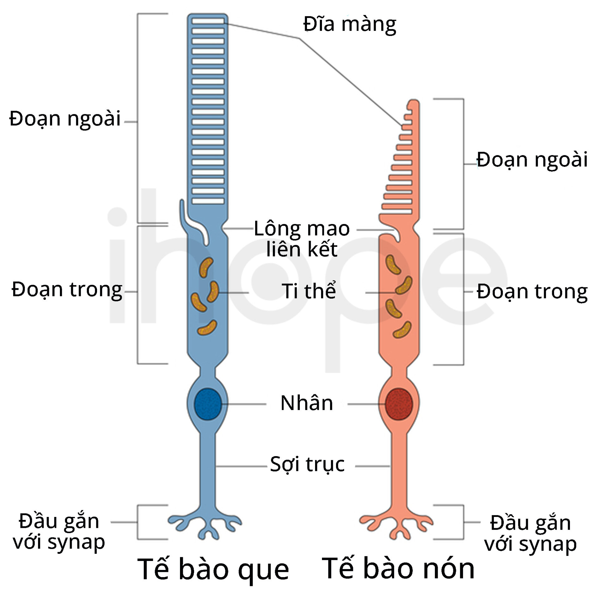Quáng gà bẩm sinh di truyền trội – ihope