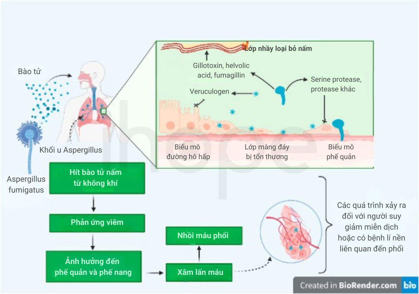 Nhiễm nấm Aspergillus – ihope
